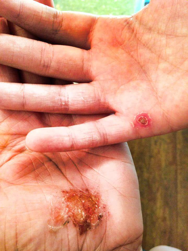 “Skin deep” // new meaning